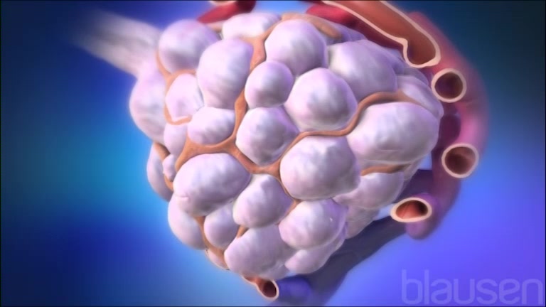 Reconstruction mammaire - animation - HUG