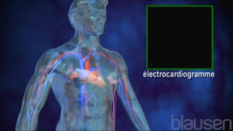 Test d’effort/ECG - HUG
