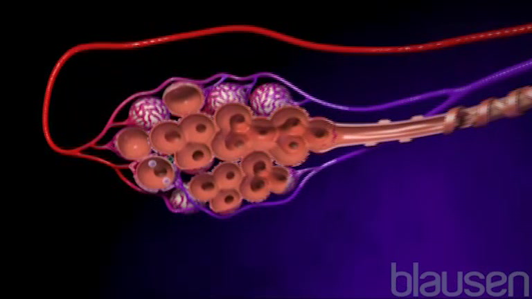 Amiantose / abestose - HUG