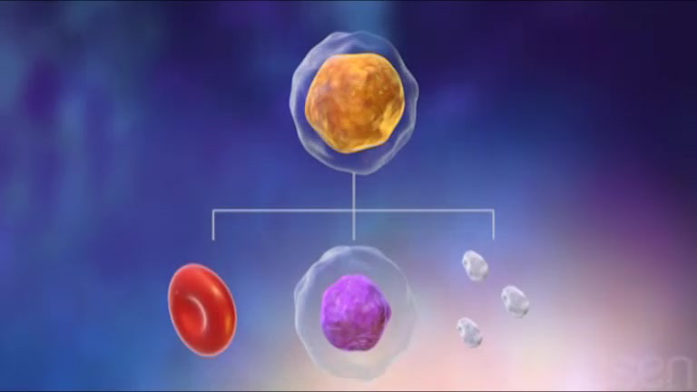 Leucémie aigüe myéloïde - HUG