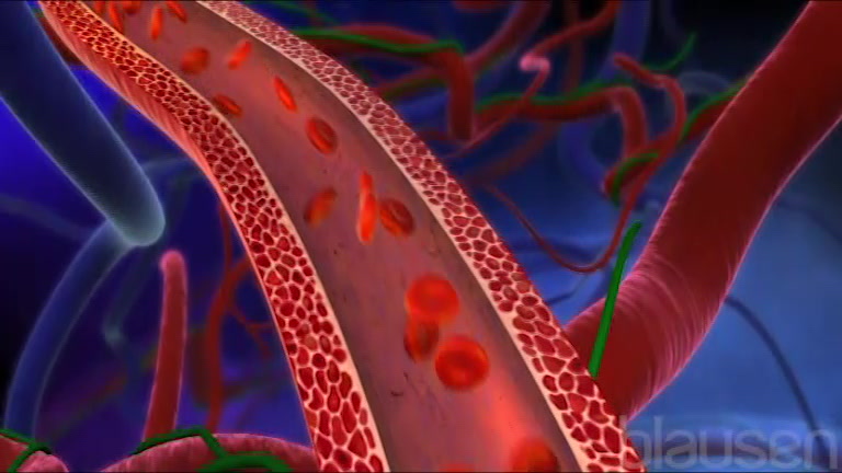 Alpha-bloquants - HUG