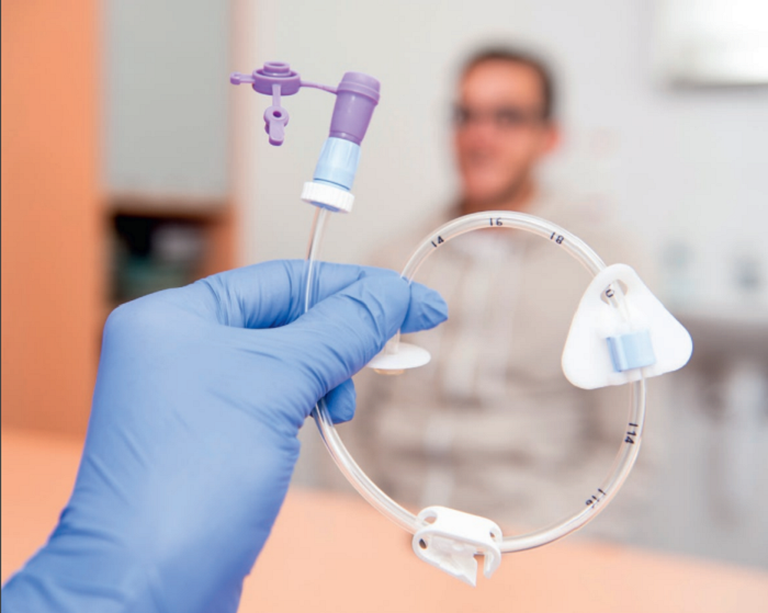 Vous avez bénéficié d’une gastrostomie endoscopique percutanée (PEG) - HUG