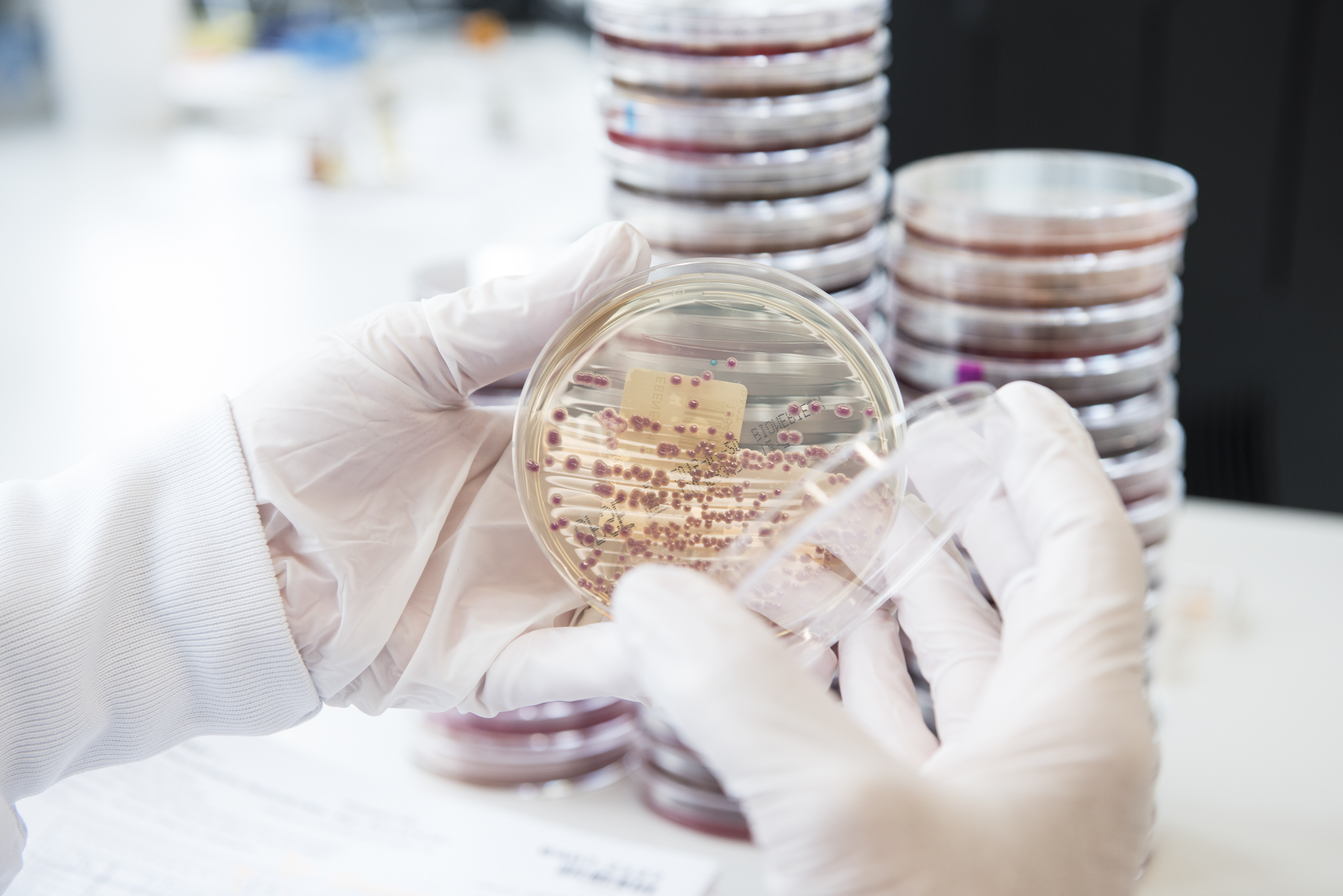 Multi-bacterial resistance to antibiotics has reached extremely ...